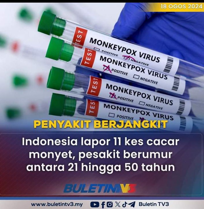 Virus Monkey Pox: Fakta Menarik dan Pencegahan Penularan – INFO DETOX ...
